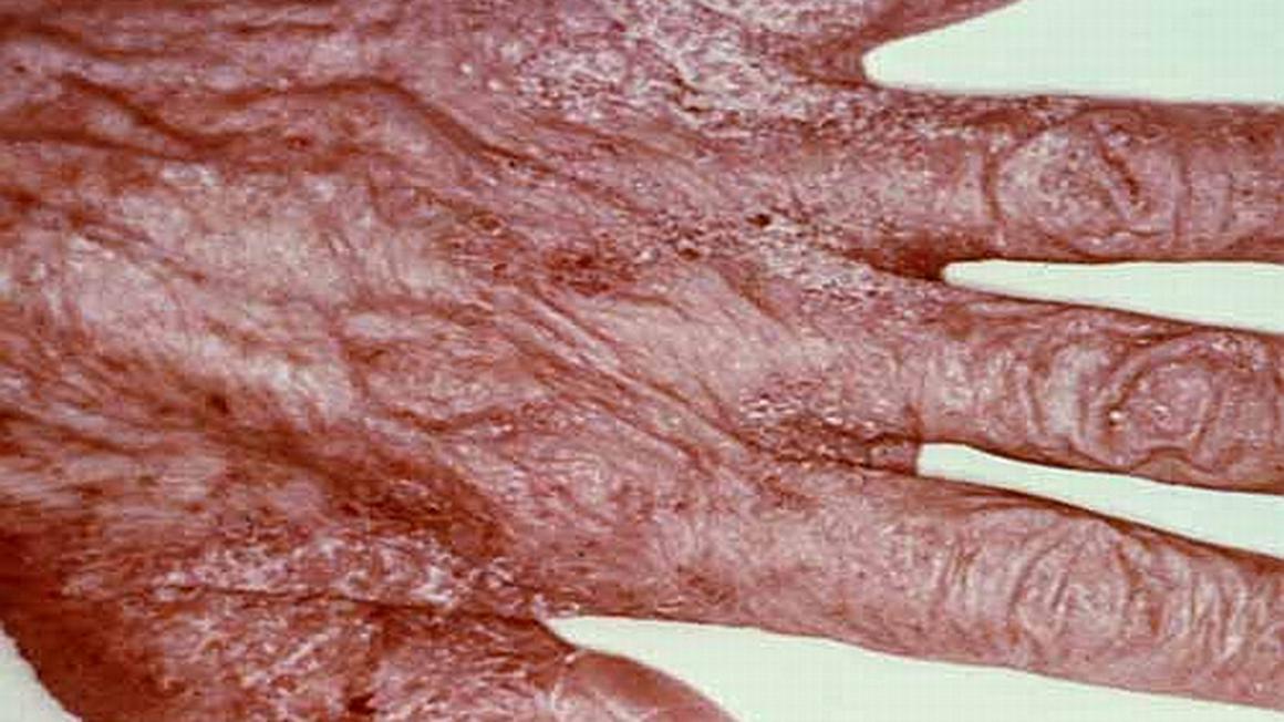 Markočič: Ne skrivajte, da imate garje! - RTVSLO.si