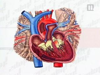 Opozorila ob svetovnem dnevu srca - RTVSLO.si