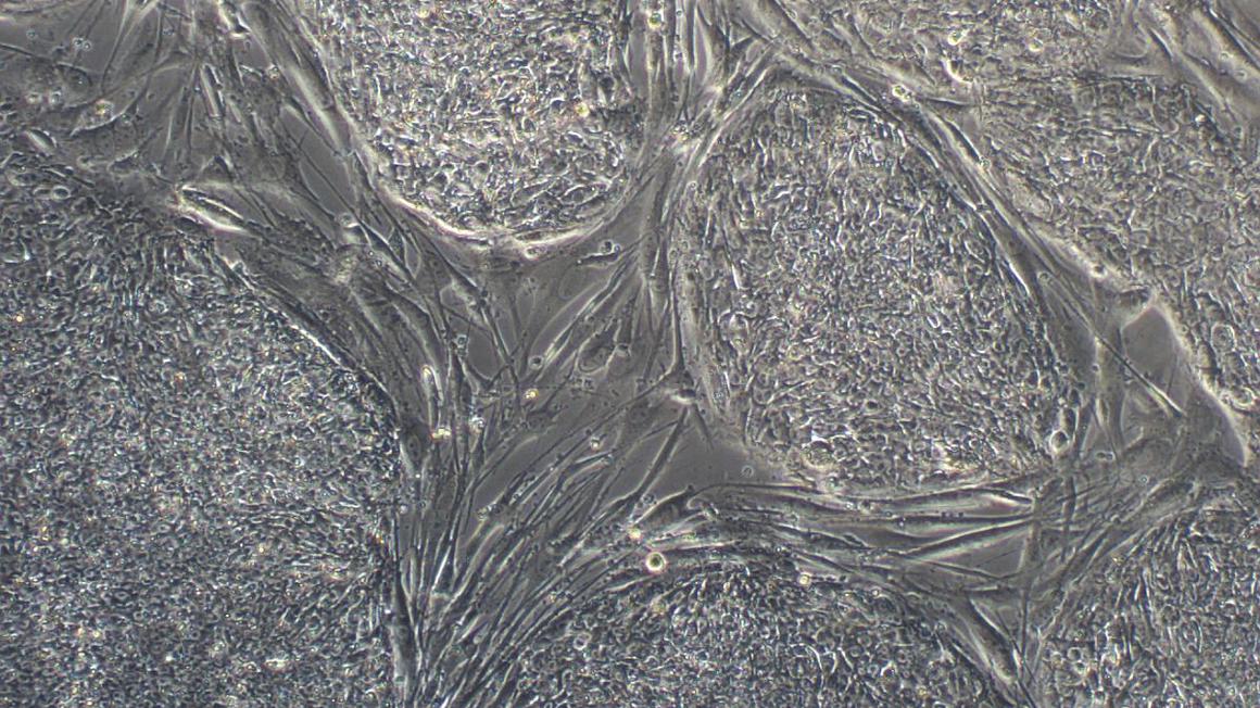 Po skoraj 15 letih od odkritja človeške embrionalne matične celice v ...