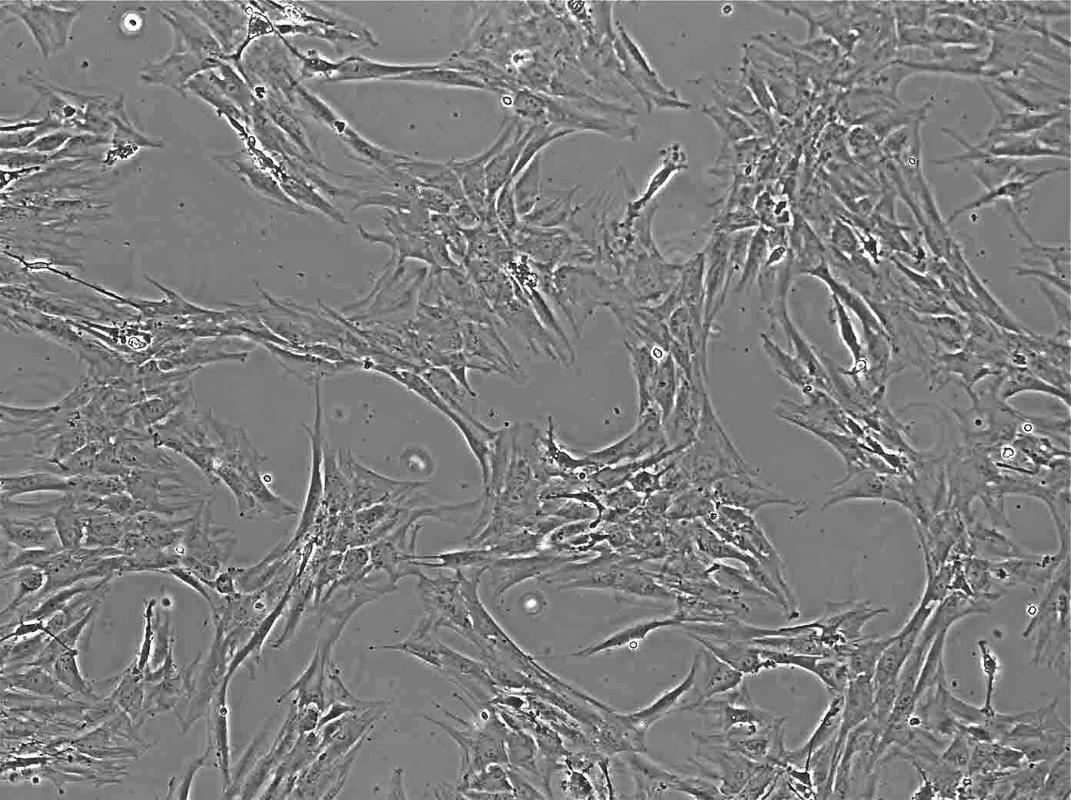 Tudi iz maščobnih tkiv lahko pridobimo matične celice za zdravljenje ...